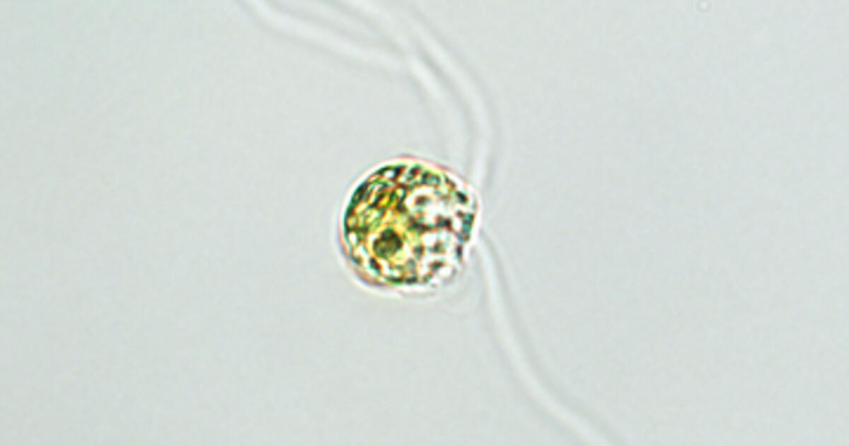algae bacteria picture