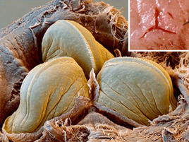 What's This? Leeches | AMNH