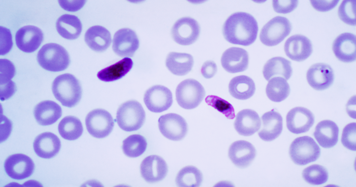 Malaria Parasite Under Microscope