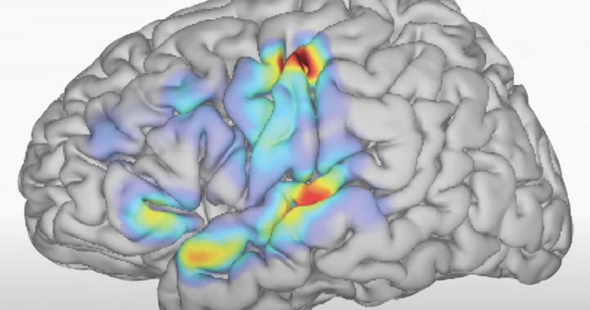 The Promise of Brain-Computer Interface | AMNH