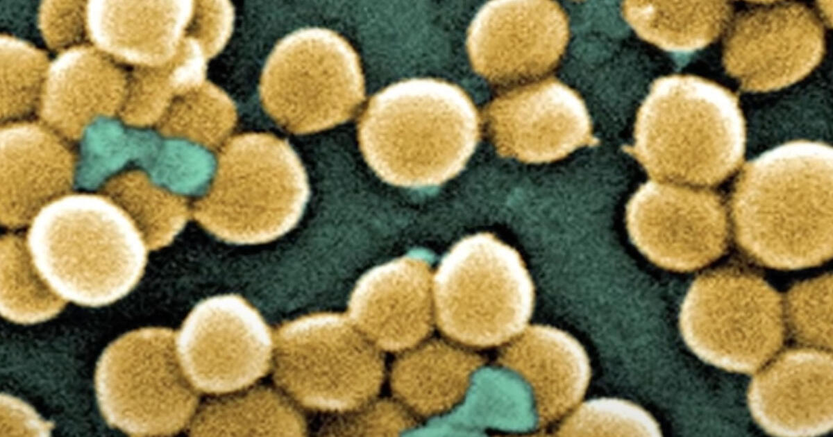 MRSA: The Evolution of a Drug-Resistant Superbug | AMNH