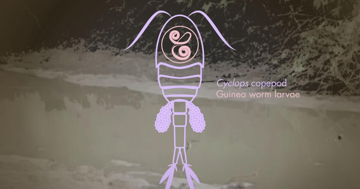 Guinea Worm Eradication in South Sudan | AMNH